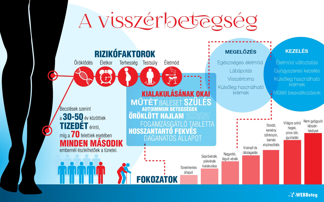 A visszérbetegség - Médiatár - WEBBeteg